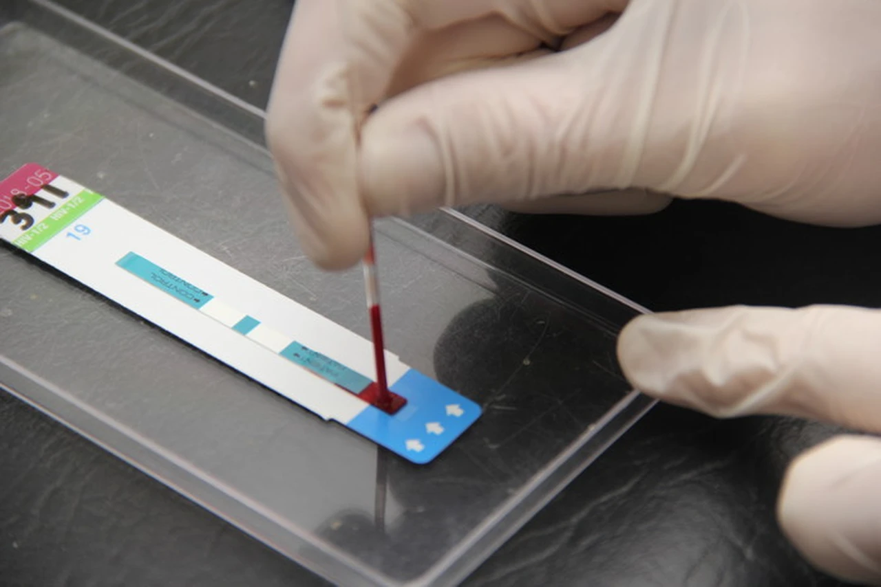 Cómo funciona el test rápido para detección de HIV