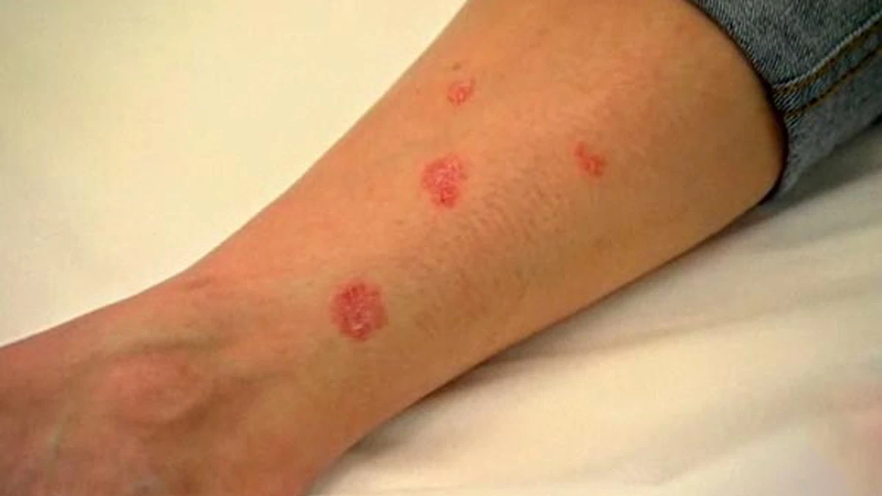 ¿Manchas rojas en la piel?: conocé las seis causas más frecuentes